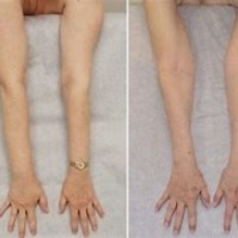 HEP2go - Build a HEP For Free